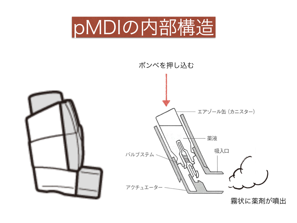 吸入指導 -pMDI編- スペーサーまで届かず・・・ | いでアレルギー・呼吸器クリニック(八代のアレルギー科、呼吸器内科、小児アレルギー科)